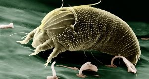 ¿Cómo Eliminar Los Ácaros De Manera Definitiva? - SoftDoc